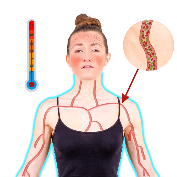 Signs of Sepsis and What To Do | SMH Activity Hub